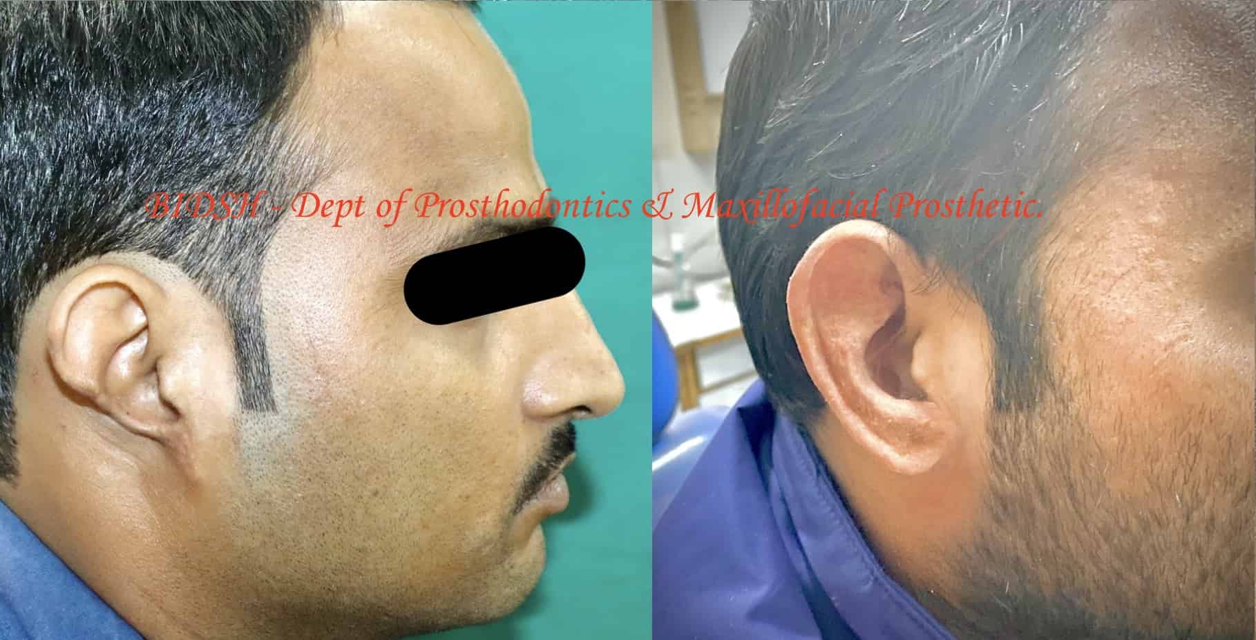 Buddha Institute of Dental Sciences & Hospital | Dental Admissions ...